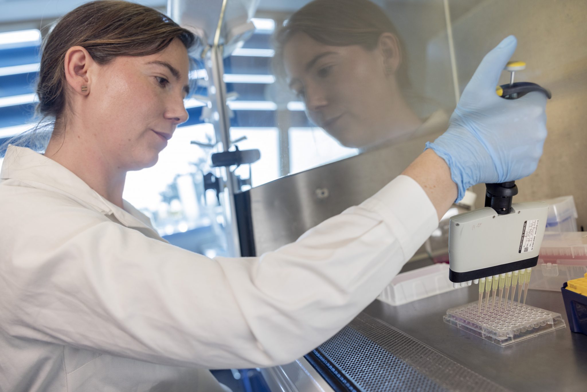 SABR_IT study explores impact of radiotherapy on immune system – Wales ...